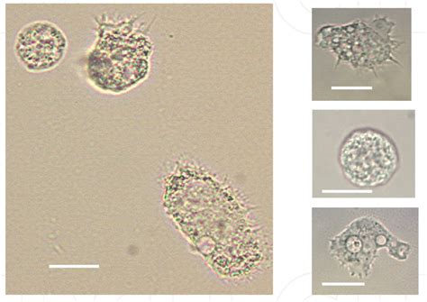 Live Acanthamoeba Trophozoites And Cysts In Unstained Preparations From