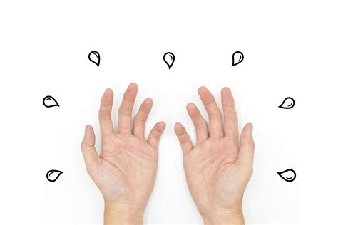 Poll What Is Your Go To Treatment For Severe Palmar Hyperhidrosis