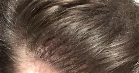 Ht Under Harsh Lighting Album On Imgur