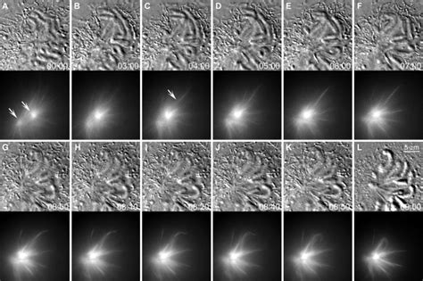 Formation Looping And Incorporation Of Microtubule Bundles In