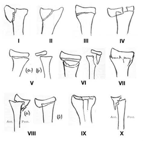 Ernest Amory Codman • Litfl • Medical Eponym Library Ernest Amory Codman • Litfl • Medical Eponym Library