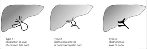 Biliary Atresia The Operative Review Of Surgery