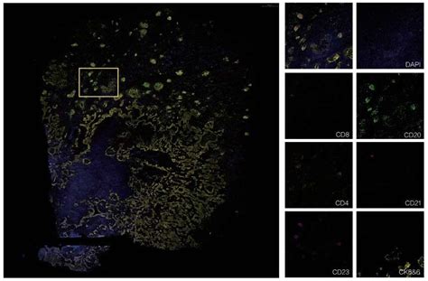 Magic Fluor™ Mihc Staining Kits Creative Diagnostics