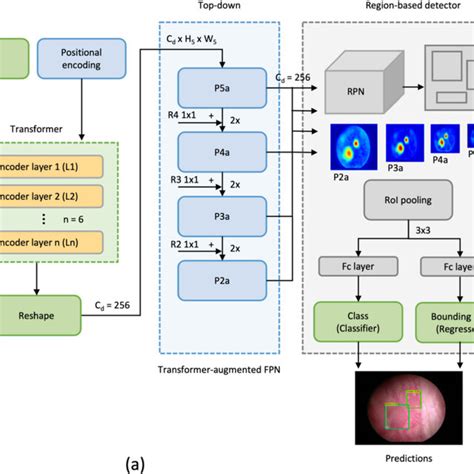 Representative Examples Of Bladder Tumor Detection Using Cystonet T