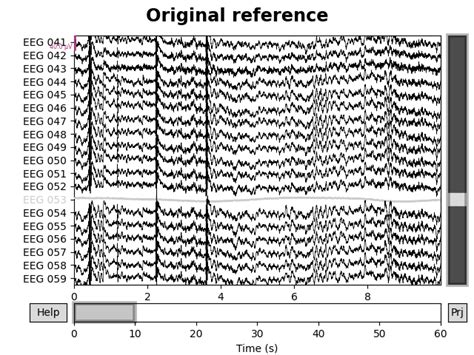 Setting The Eeg Reference — Mne 0 22 1 Documentation