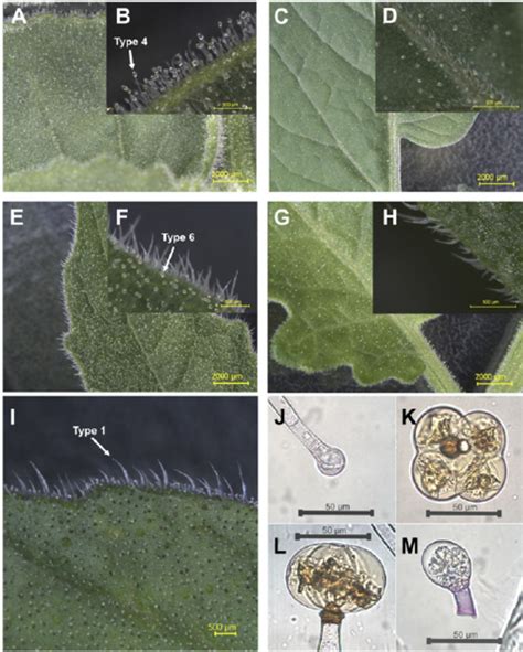 Glandular Trichome Density And Distribution Among Four Of The Five