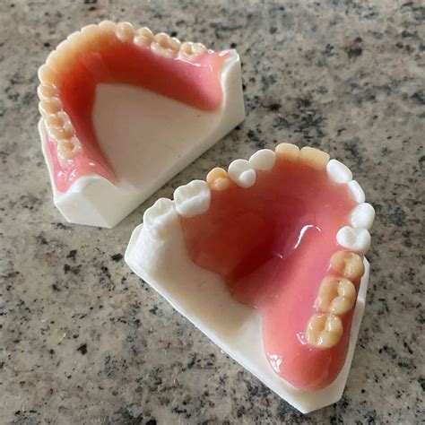 Teaching Denture Model Partial Upper