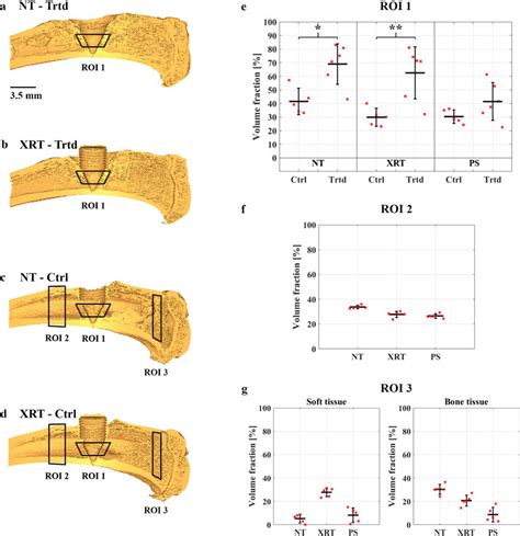 Comparison Of Volume Fractions Of Bone Tissue And Soft Tissue Segmented Download Scientific