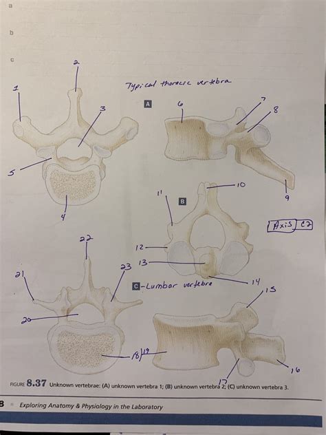 Vertebrae Diagram Quizlet Vertebrae Diagram Quizlet
