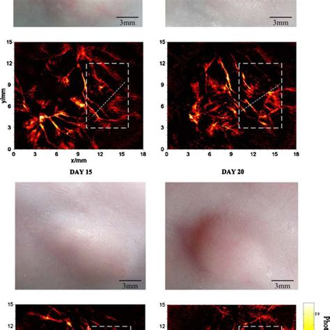 Pdf Noninvasive Photoacoustic Imaging Of The Developing Vasculature During Early Tumor Growth
