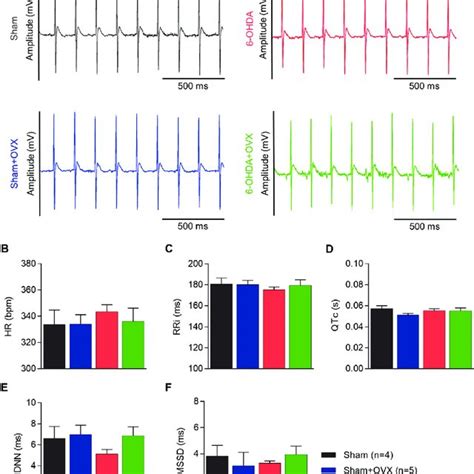 Heart Rate Variability Parameters Time Domain Analysis A Download Scientific Diagram