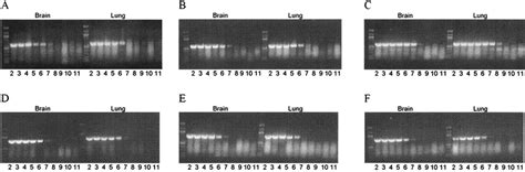 Sensitivity Of 3 Rna Extraction Procedures Followed By The One Step