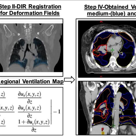 Schematic Diagram For Creating Anatomical Treatment Plan And 4dct Download Scientific Diagram