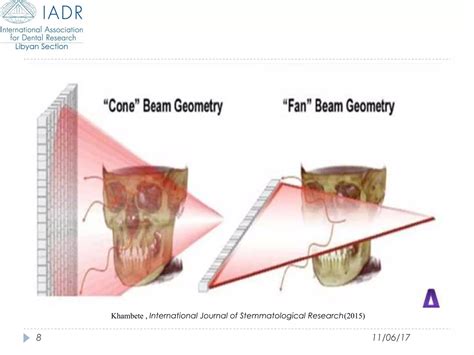 Use Of Cone Beam Computed Tomography In Endodontics Ppt