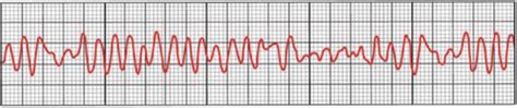 acls megacode doses and some other cheeky info flashcards quizlet