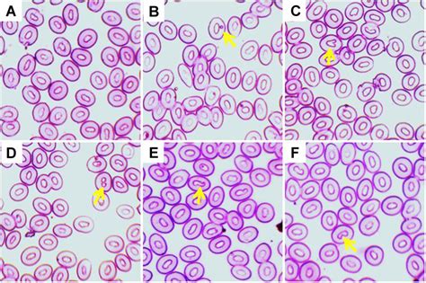 Frontiers Nuclear And Cellular Abnormalities Of Erythrocytes In