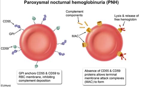 Paroxysmal Nocturnal Hemoglobinuria Flashcards Quizlet