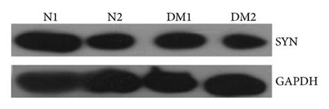 Decline In Dendritic Spine Density In The Frontal Cortex And Download Scientific Diagram