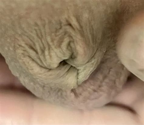 me and my inverted cock 9 pics xhamster