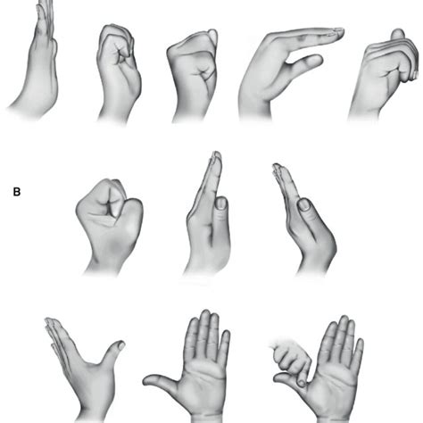 A Example Of The Sequence Of Finger Movements During Tendon Gliding