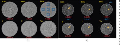 Evaluation Of Fan Beam Kilovoltage Computed Tomography Image Quality On A Novel Biological