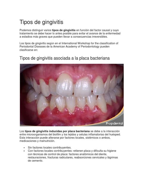 Tipos De Gingivitis Pdf Enfermedades Y Trastornos Medicina