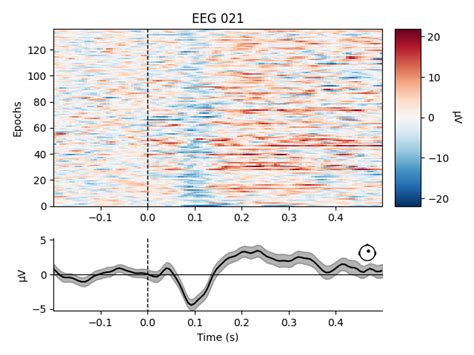 overview of meg eeg analysis with mne python — mne 1 1 1 documentation