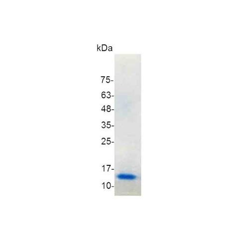 BDNF, Human - Atlantis Bioscience Pte Ltd