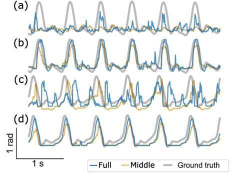 Figure 11 From Leveraging High Density Emg To Investigate Bipolar