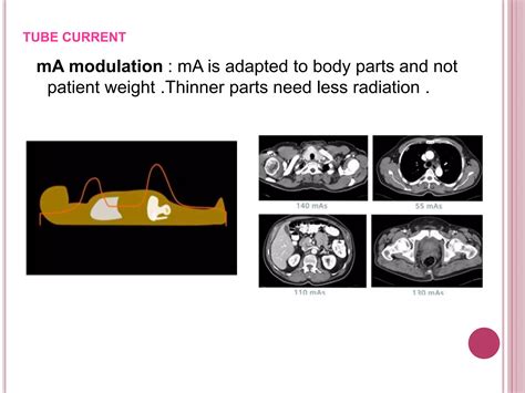Ct Radiation Dose Reduction Pptx