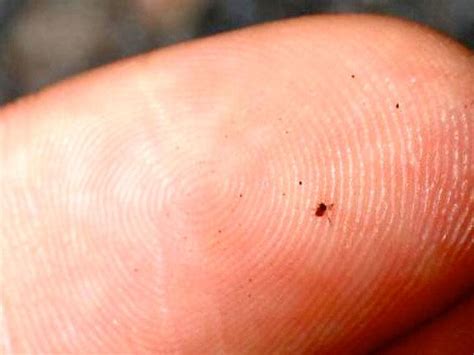 Where Do Chiggers Live Everything You Need To Know
