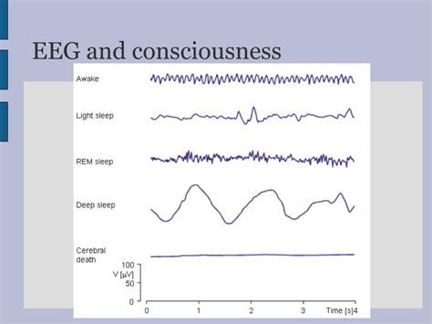 Ppt Introduction To Eeg Emg Ncv Powerpoint Presentation Free Download Id 6624973