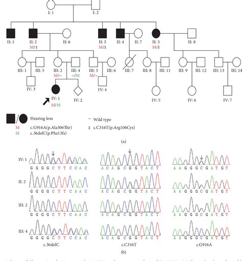 Figure 1 From Novel Mutations And Mutation Combinations Of Tmprss3