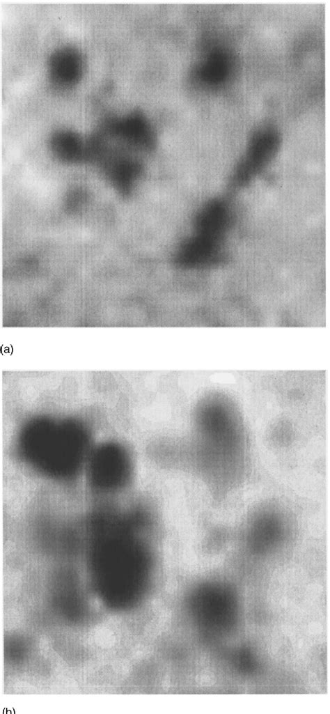 Figure 4 From The Detection Of Breast Microcalcifications With Medical Ultrasound Semantic
