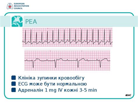 Advanced Life Support Algorithm