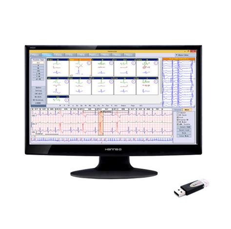 Analysis Software Itengo Borsam Biomedical Instrument Reporting