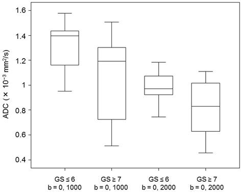 box and whisker plots show adc values of low risk prostate cancer
