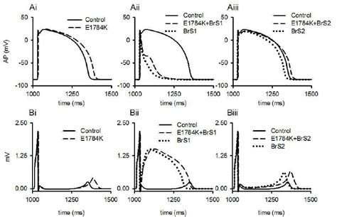 Computed Aps Of Epi Cell And Pseudo Ecgs In The Strand Model At 1 Hz Download Scientific