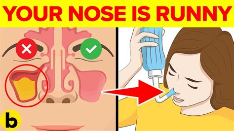Why Does My Nose Keep Running On One Side Online