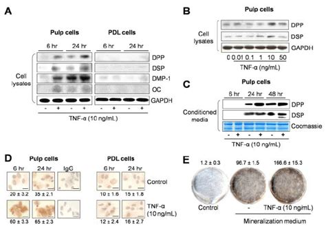 Expression Of Mineralization Associated Proteins And Mineralized Nodule Download Scientific
