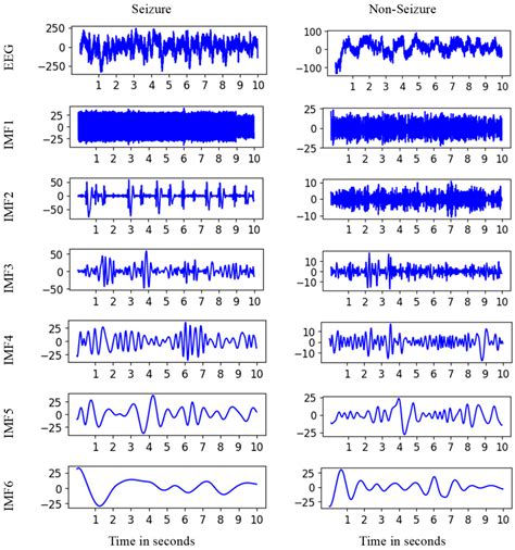 Epileptic Seizure Detection From Decomposed Eeg Signal Through 1d And 2d Feature Representation