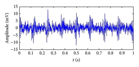 Time Series Of Measured Signal Download Scientific Diagram