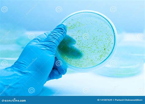 Colony Of Blue Green Algae In Culture Medium Plate Stock Image Image
