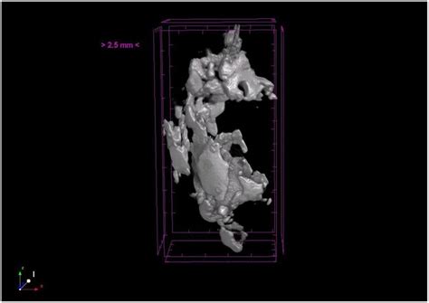Micro Ct Image Of A Fibrocalcific Plaque Sample In Which The Download Scientific Diagram