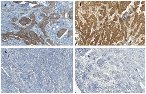 ihc staining for c met and pyy1234 1235 met in opscc download