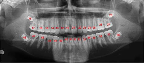 Fdi Tooth Numbering System A Sample Tooth Repository Following The Fdi
