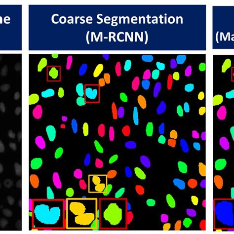 Fine Segmentation Of Overlapping Nuclei By Marker Controlled Watershed