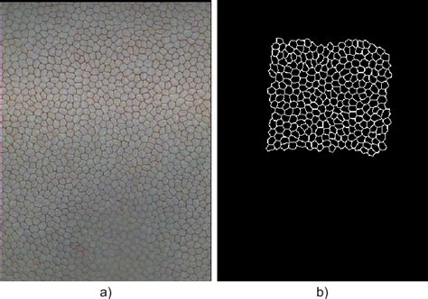 Figure 1 From Corneal Endothelium Image Segmentation Using Feedforward Neural Network Semantic