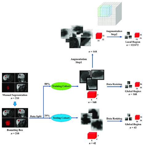 image preprocessing and data augmentation the tumor was segmented at