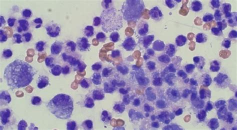 Day 1 Cytology Large Mononuclear Cells Neutrophils And Bacterial Download Scientific